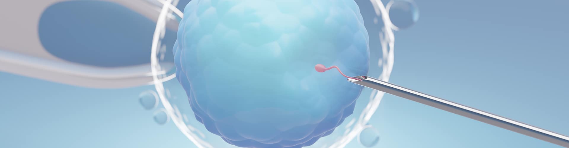 IVF | ICSI | IMSI| Frozen Embryo Transfer| Natural IVF Treatments