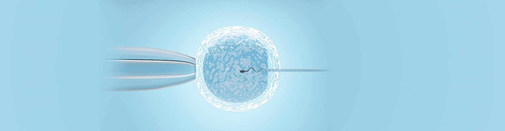 Best fertility treatment | Intracytoplasmic Sperm injection | ICSI