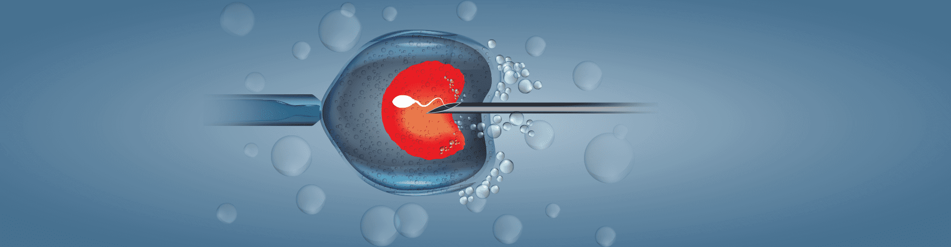 Best IMSI Fertility Treatment in Hyderabad | IMSI IVF Treatment - Felicity